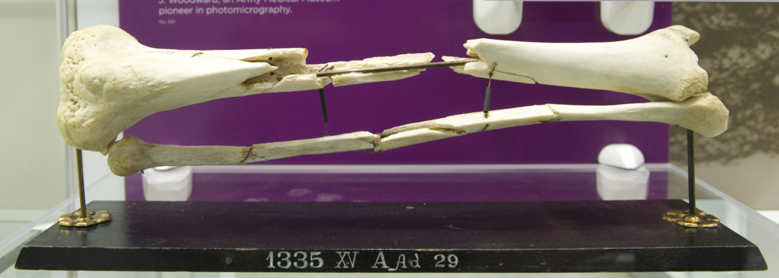 5 Famous Body Parts From History That You Can Visit