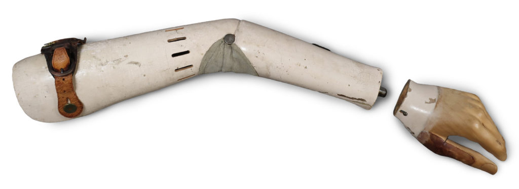 How the Civil War Advanced the Industry of Prosthetics