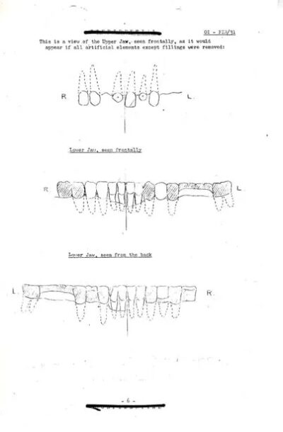 hitlers-teeth-upper-jaw | HistoryNet